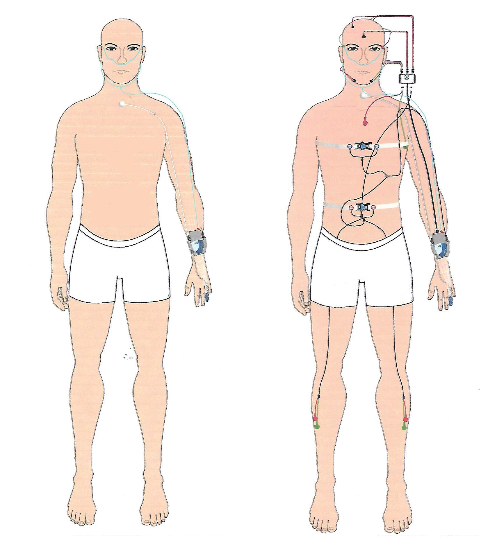 Le dépistage de l'apnée du sommeil dans les Yvelines